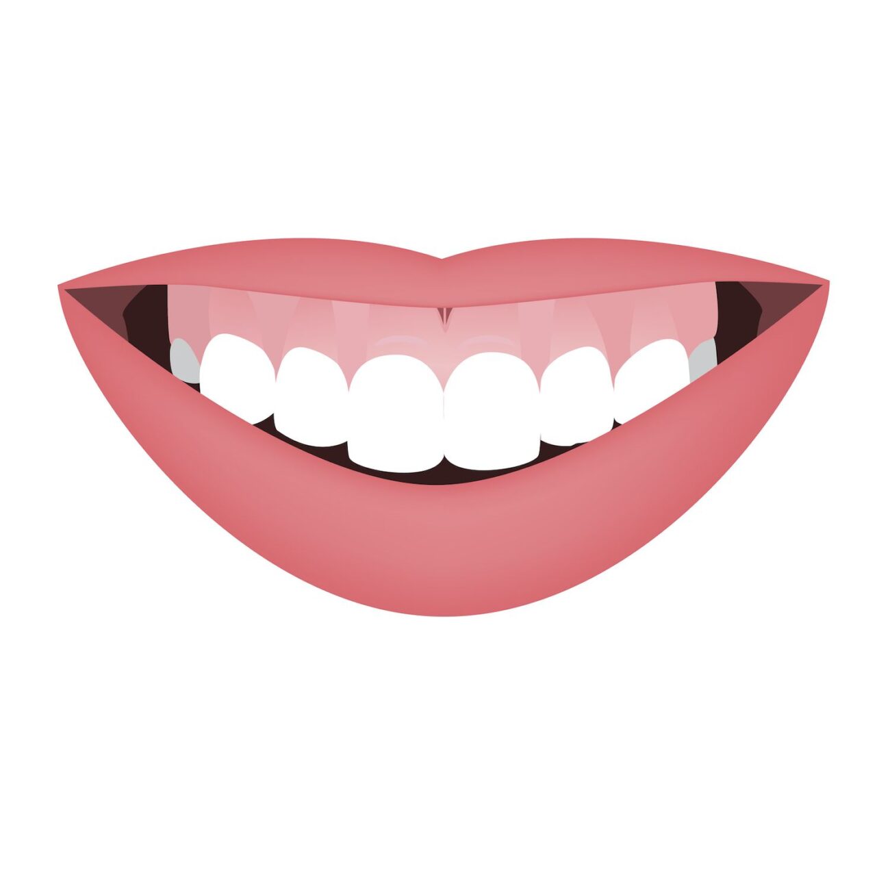 Gummy Smile: Dental or Aesthetic?- Orthodontics in Timonium, MD